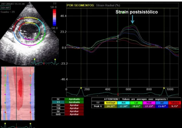 Metodología - Deformación miocárdica y torsión ventricular en enfermos ...