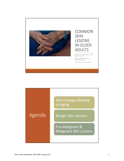 Agenda COMMON SKIN LESIONS IN OLDER ADULTS. Skin Changes Related to ...