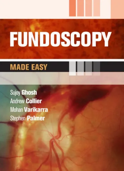 29Fundoscopy Made Easy - Fundus and Its Variants