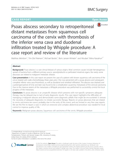 Psoas abscess secondary to retroperitoneal distant metastases from ...